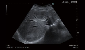 富士フィルム 超音波診断装置 ARIETTA 650 DeepInsight（アリエッタ 650 ディープインサイト） – 株式会社キカイヤ