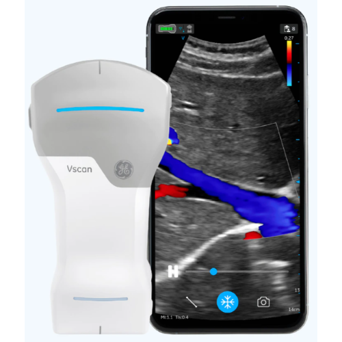 GE 超音波診断装置 Venue Go (ベニューゴー) – 株式会社キカイヤ