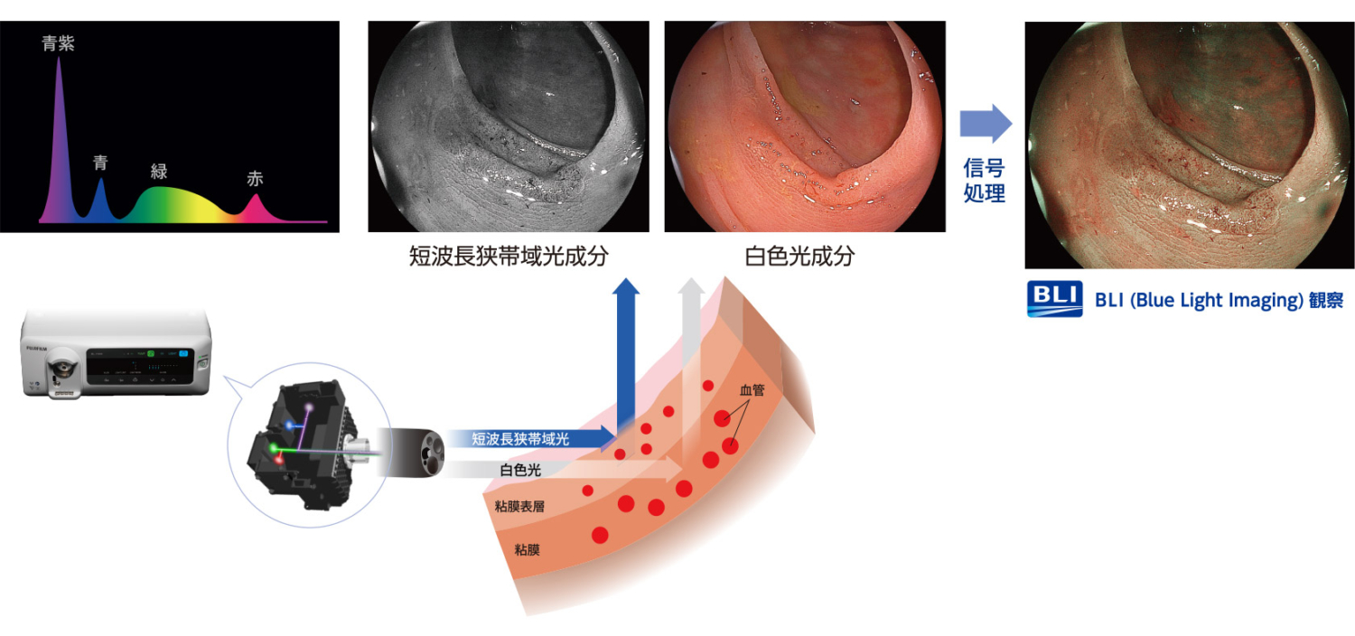富士 内視鏡システム ELUXEO 7000システム (エルクセオ7000システム) – 株式会社キカイヤ