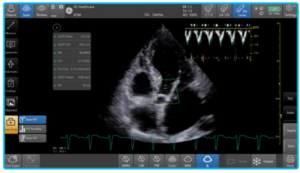 GE 超音波診断装置 Venue Go (ベニューゴー) – 株式会社キカイヤ