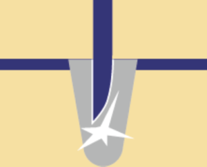 アムコ 高周波手術装置 VIO100C（バイオ100C） – 株式会社キカイヤ